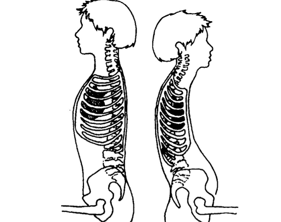 Slouching – mitzvahtechnique.ca